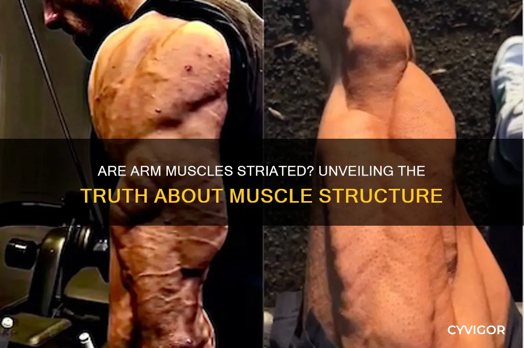 Are Arm Muscles Striated? Unveiling The Truth About Muscle Structure ...