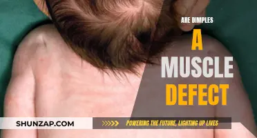 Dimples: Muscular Deformity Or Genetic Luck? | CyVigor