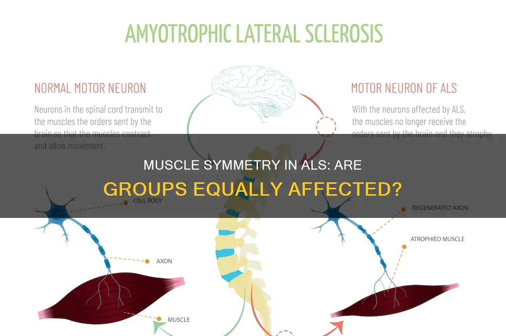 Muscle Symmetry In Als: Are Groups Equally Affected? | CyVigor