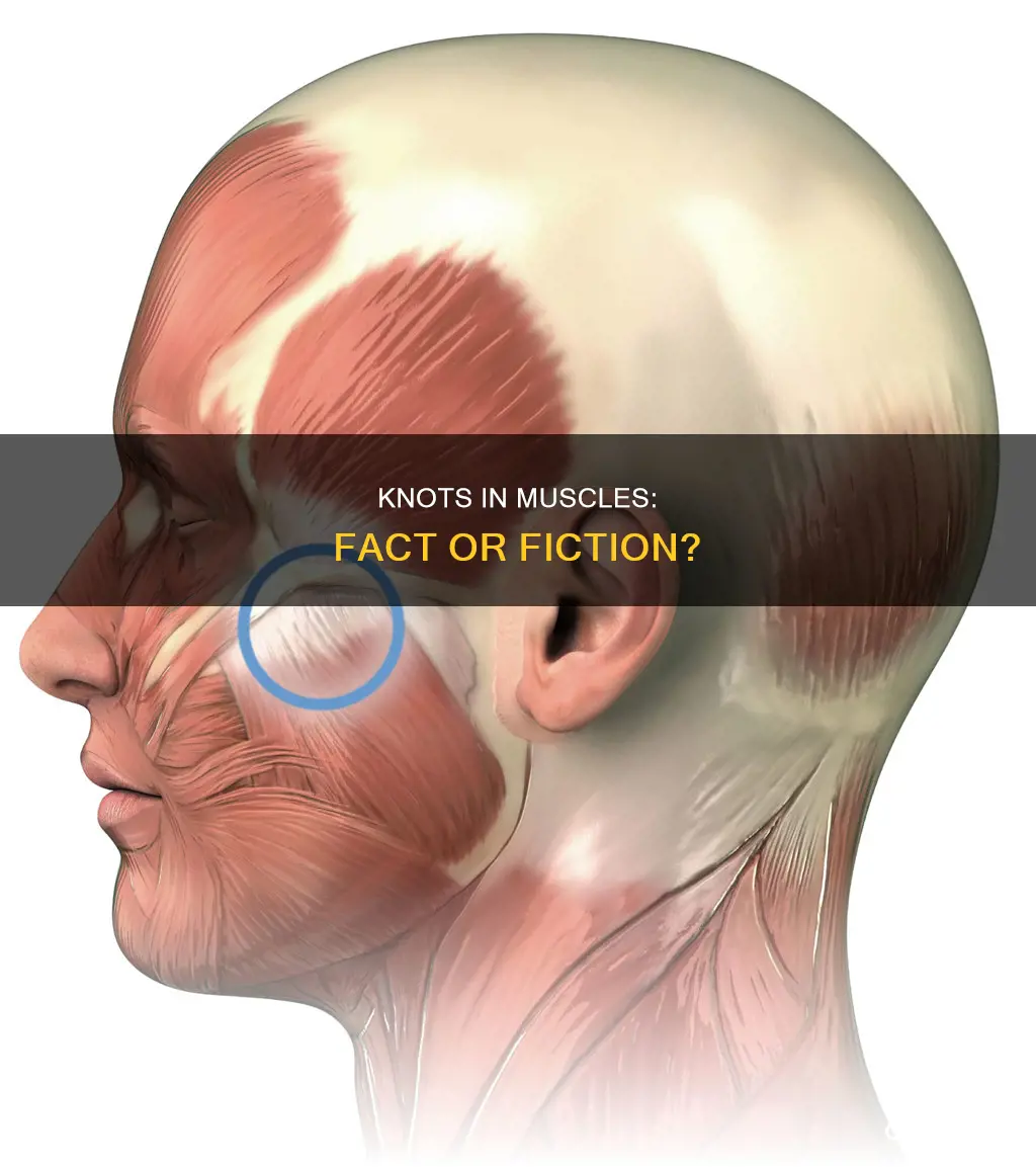 Knots In Muscles: Fact Or Fiction? | CyVigor