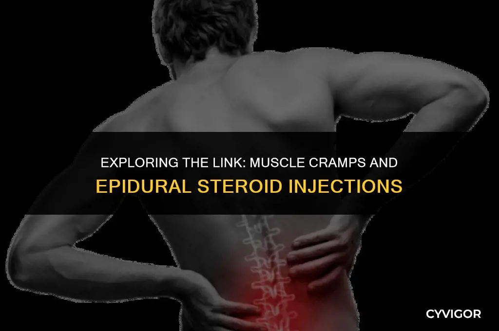 Exploring The Link: Muscle Cramps And Epidural Steroid Injections | CyVigor