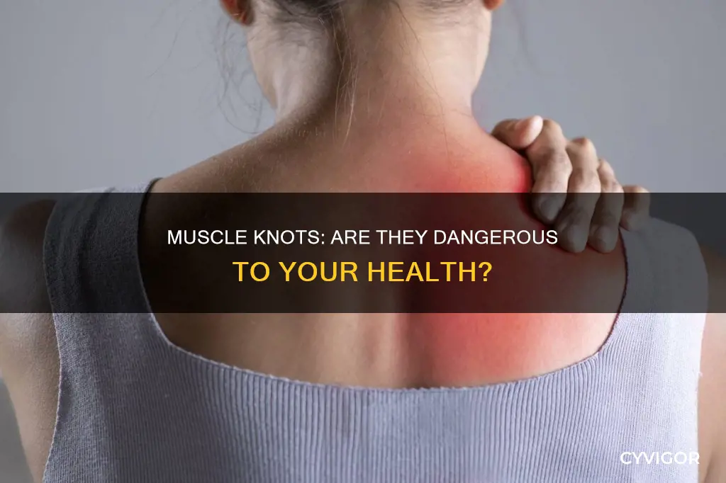 Muscle Knots: Are They Dangerous To Your Health? | CyVigor