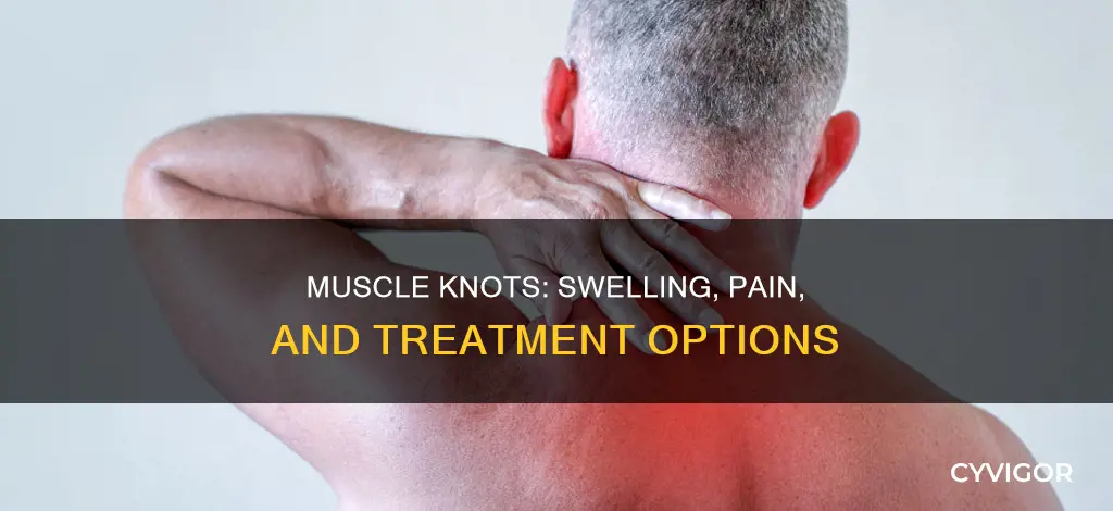 Muscle Knots: Swelling, Pain, And Treatment Options | CyVigor