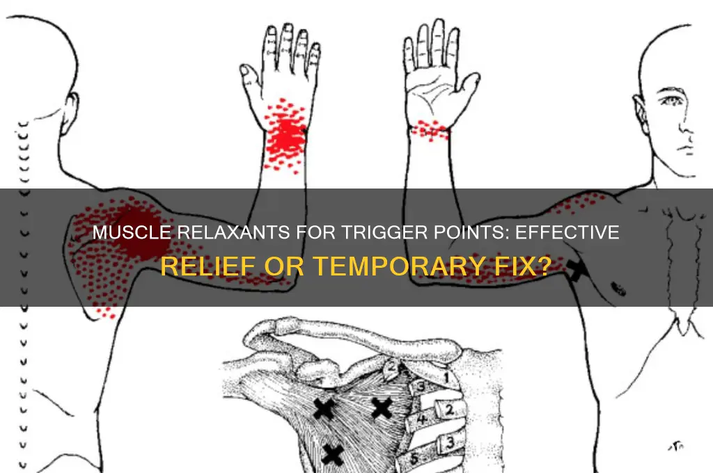 Muscle Relaxants For Trigger Points: Effective Relief Or Temporary Fix ...