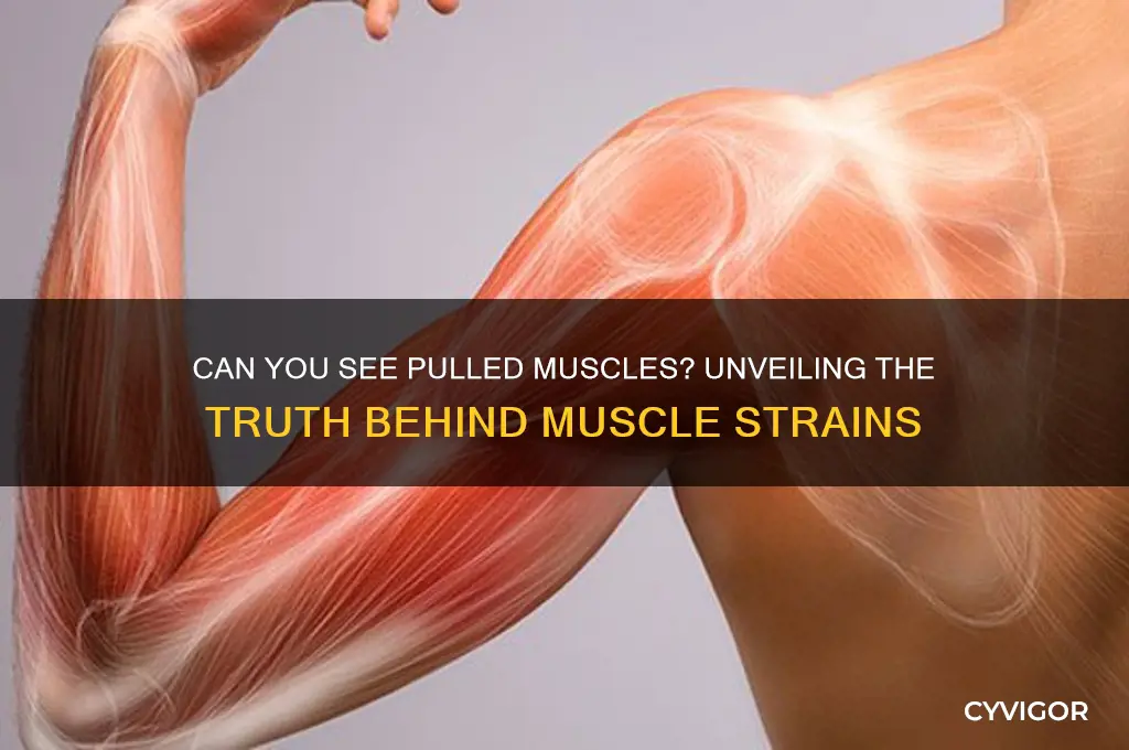 Can You See Pulled Muscles? Unveiling The Truth Behind Muscle Strains ...