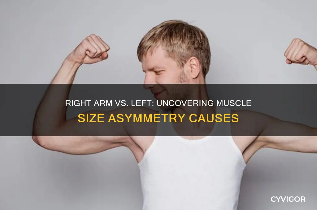 Right Arm Vs. Left: Uncovering Muscle Size Asymmetry Causes | CyVigor