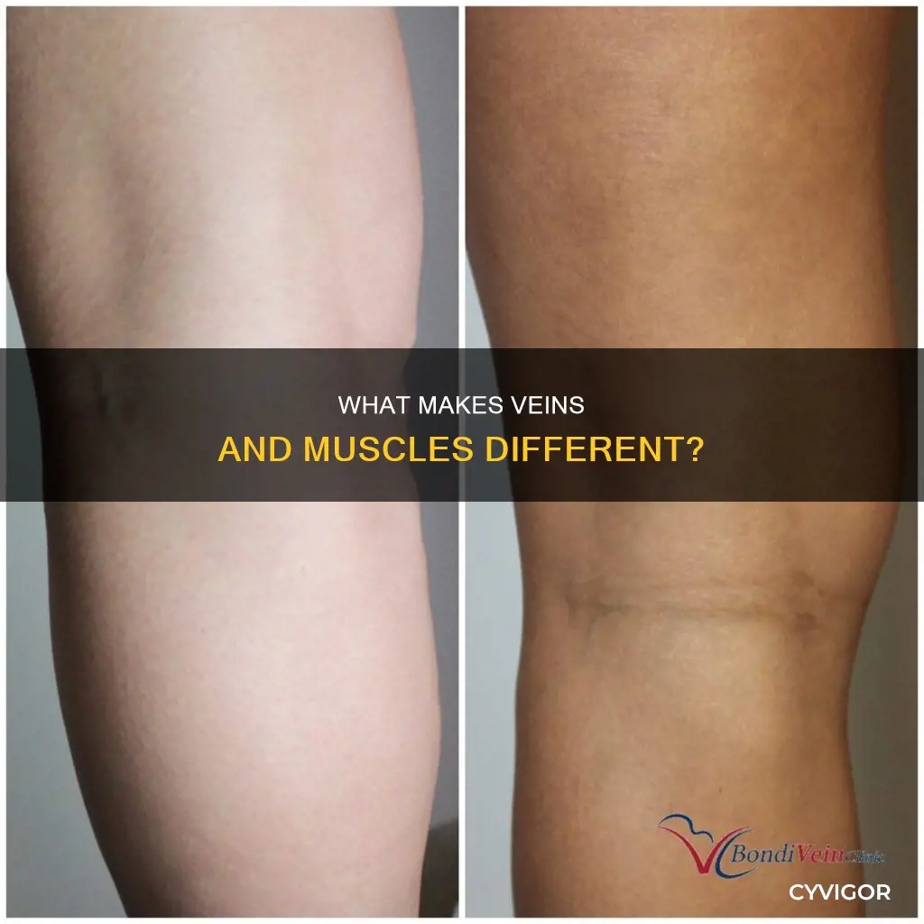 What Makes Veins And Muscles Different? | CyVigor