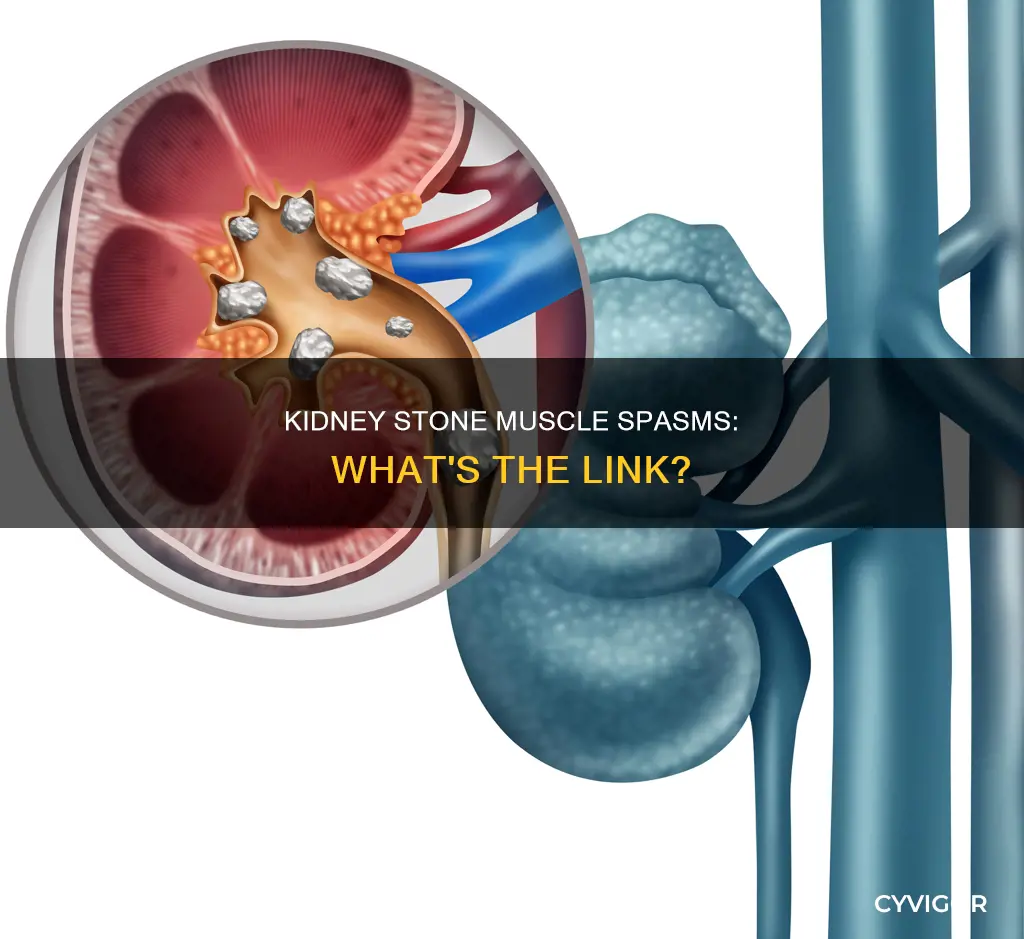 Kidney Stone Muscle Spasms: What's The Link? | CyVigor