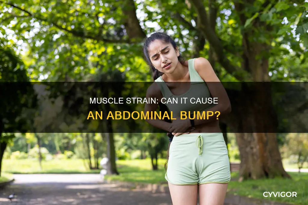 Muscle Strain: Can It Cause An Abdominal Bump? | CyVigor