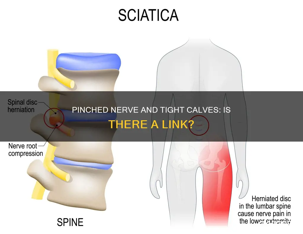 Pinched Nerve And Tight Calves: Is There A Link? | CyVigor