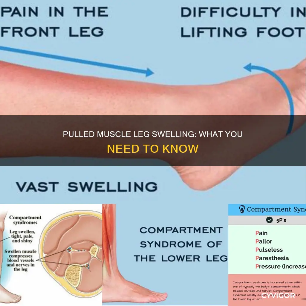 Pulled Muscle Leg Swelling: What You Need To Know | CyVigor