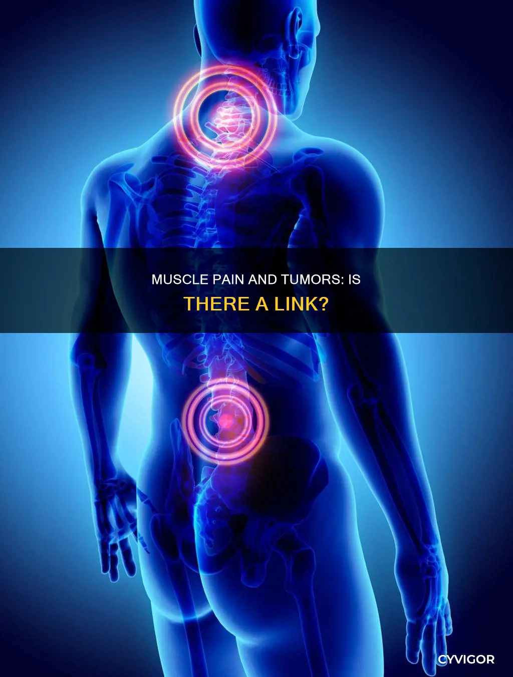 Muscle Pain And Tumors: Is There A Link? | CyVigor