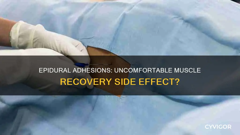Epidural Adhesions: Uncomfortable Muscle Recovery Side Effect? | CyVigor