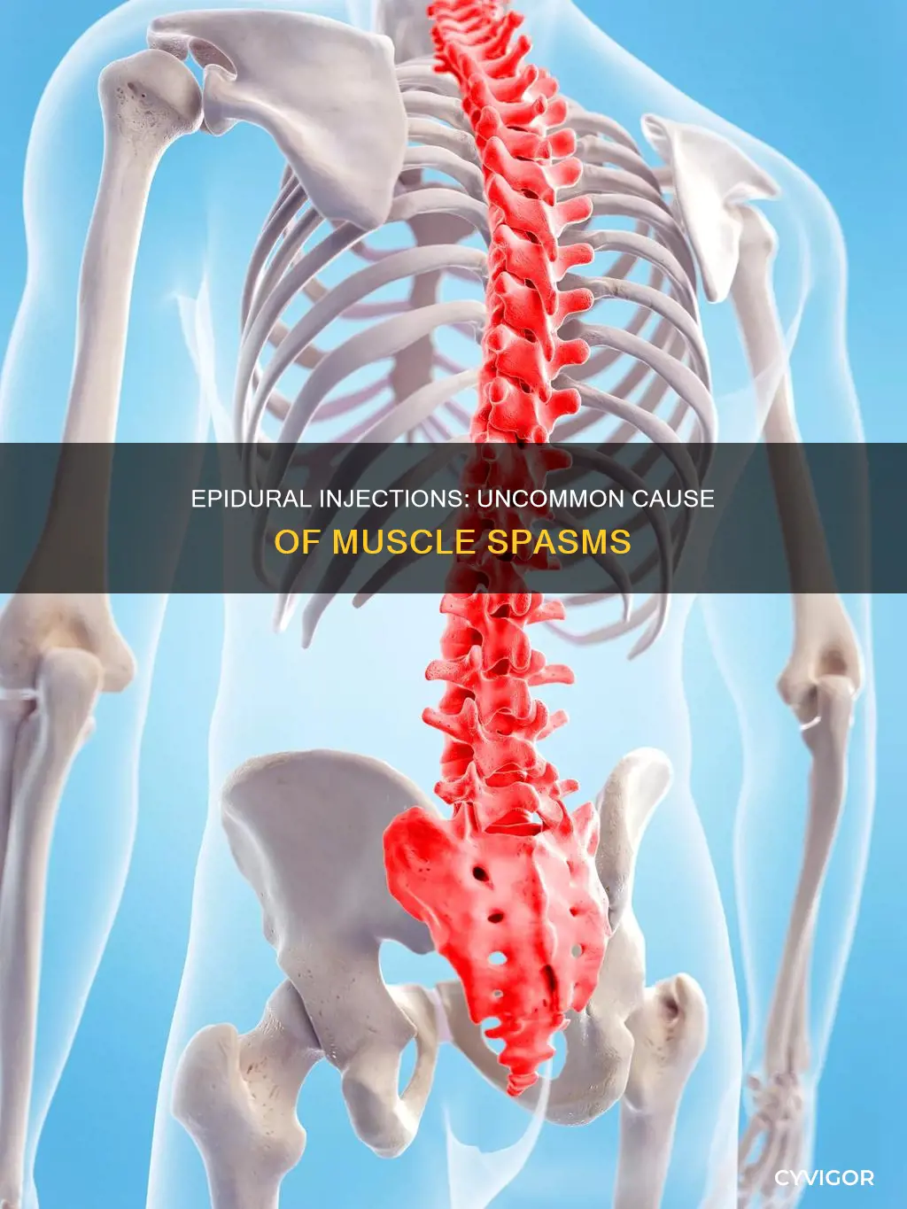 Epidural Injections: Uncommon Cause Of Muscle Spasms | CyVigor