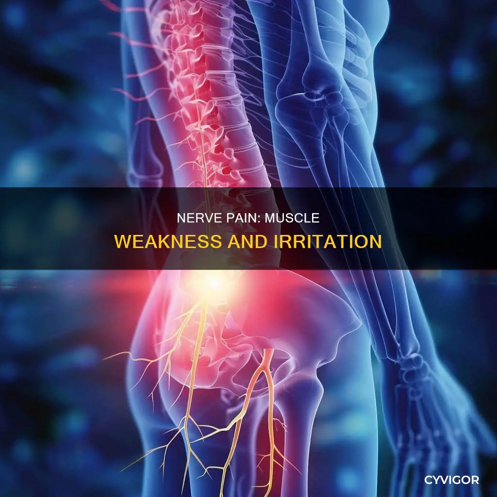 Nerve Pain: Muscle Weakness And Irritation | CyVigor