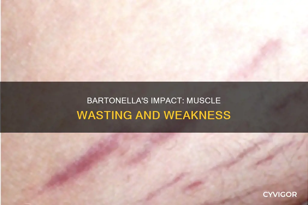 Bartonella's Impact: Muscle Wasting And Weakness | CyVigor