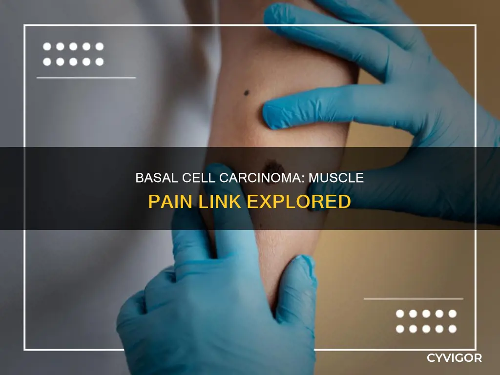 Basal Cell Carcinoma: Muscle Pain Link Explored | CyVigor