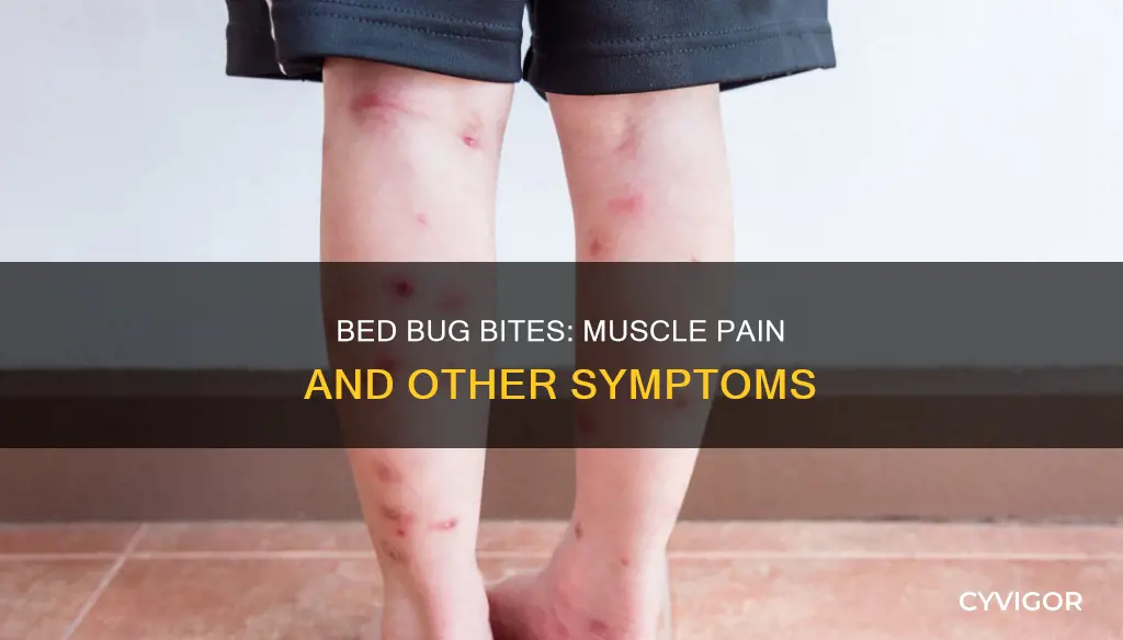 Bed Bug Bites: Muscle Pain And Other Symptoms | CyVigor