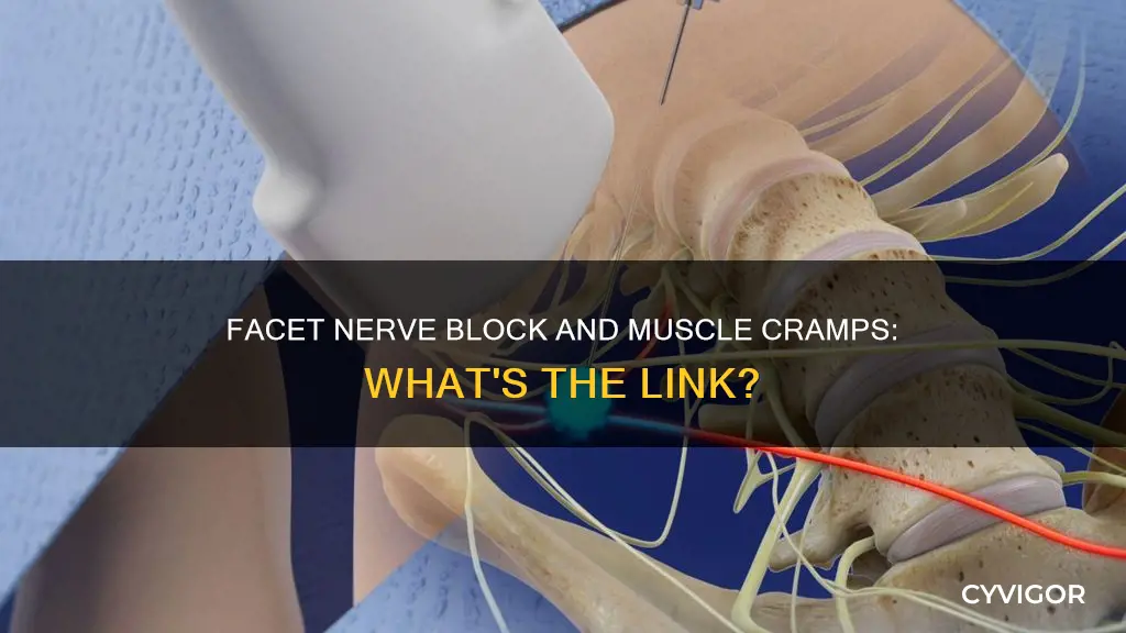 Facet Nerve Block And Muscle Cramps: What's The Link? | CyVigor