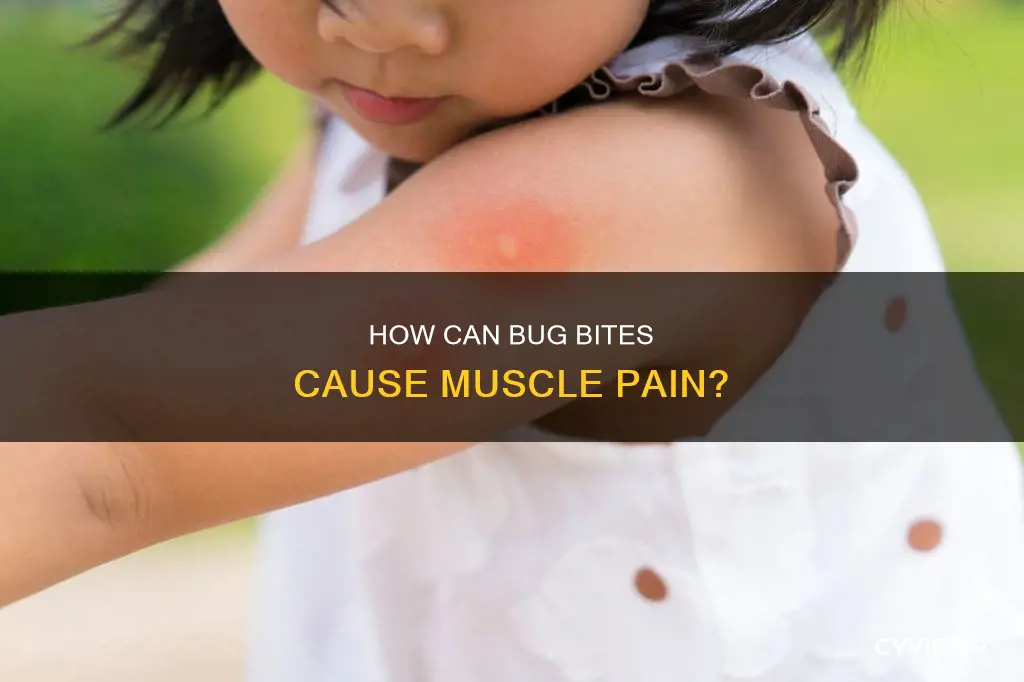 How Can Bug Bites Cause Muscle Pain? | CyVigor