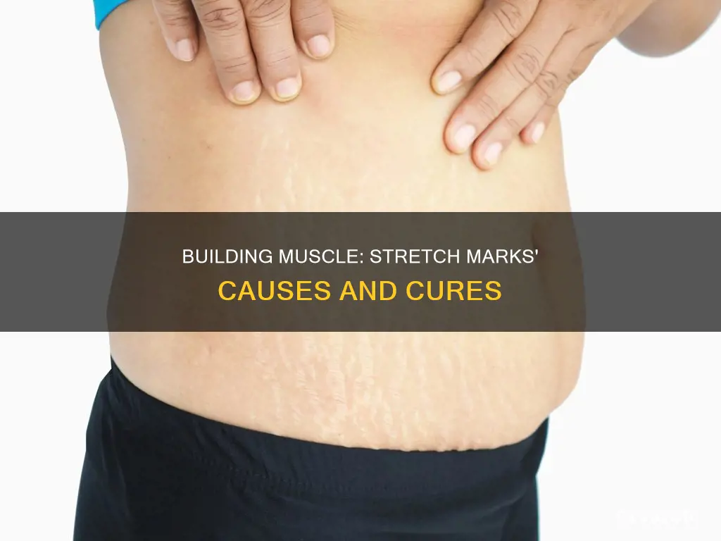 Building Muscle: Stretch Marks' Causes And Cures | CyVigor