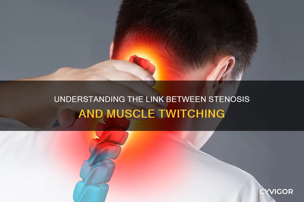 Understanding The Link Between Stenosis And Muscle Twitching | CyVigor