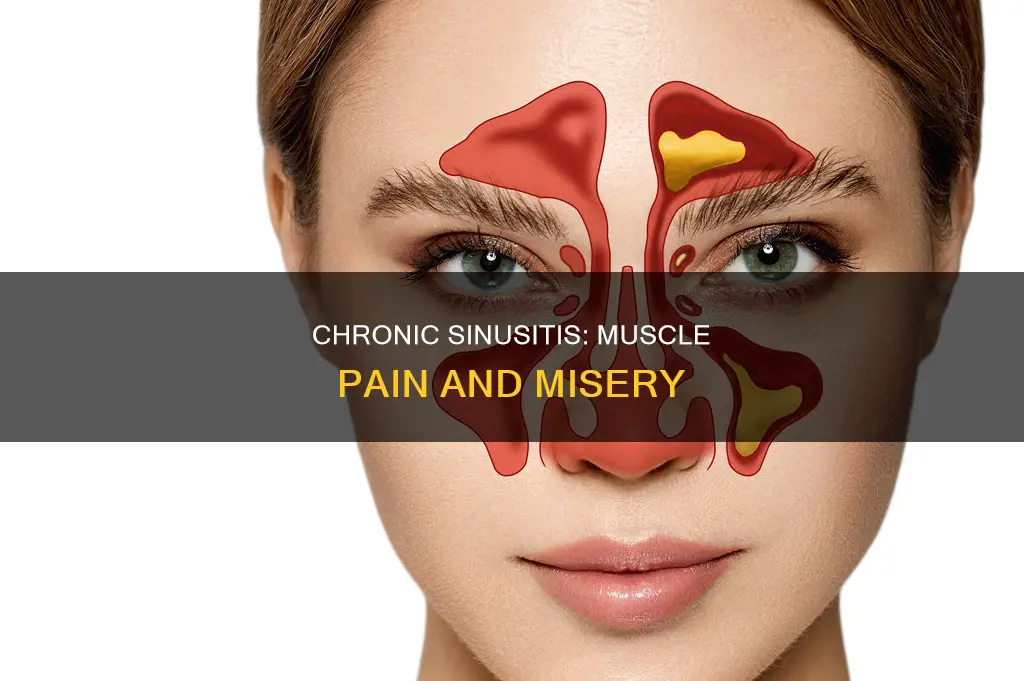 Chronic Sinusitis: Muscle Pain And Misery | CyVigor