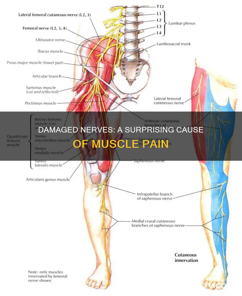 Damaged Nerves: A Surprising Cause Of Muscle Pain | CyVigor