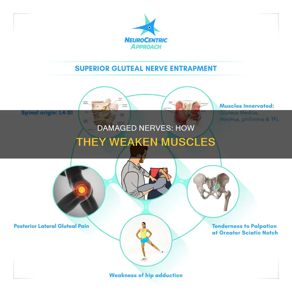 Damaged Nerves: How They Weaken Muscles | CyVigor