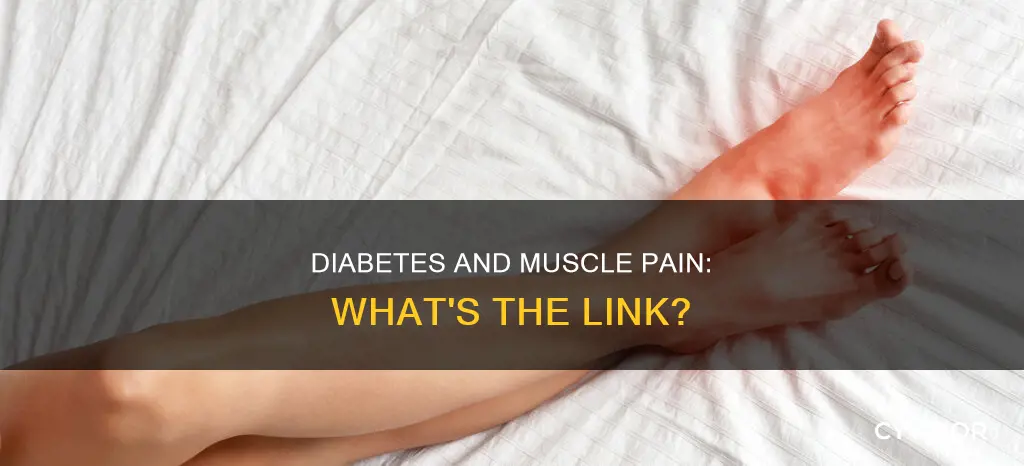 Diabetes And Muscle Pain: What's The Link? | CyVigor