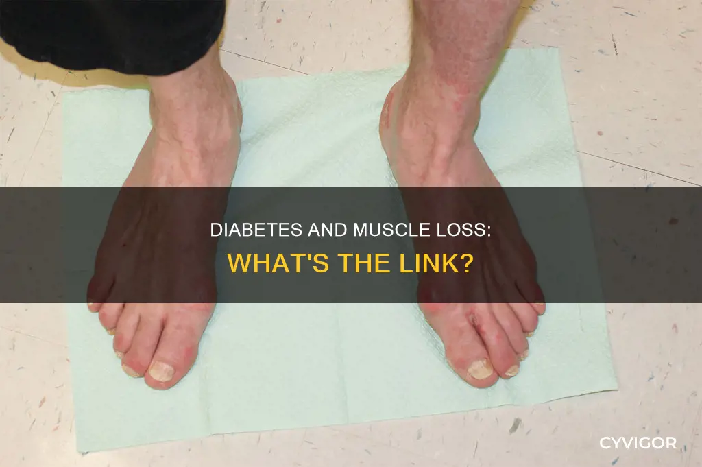 Diabetes And Muscle Loss: What's The Link? | CyVigor