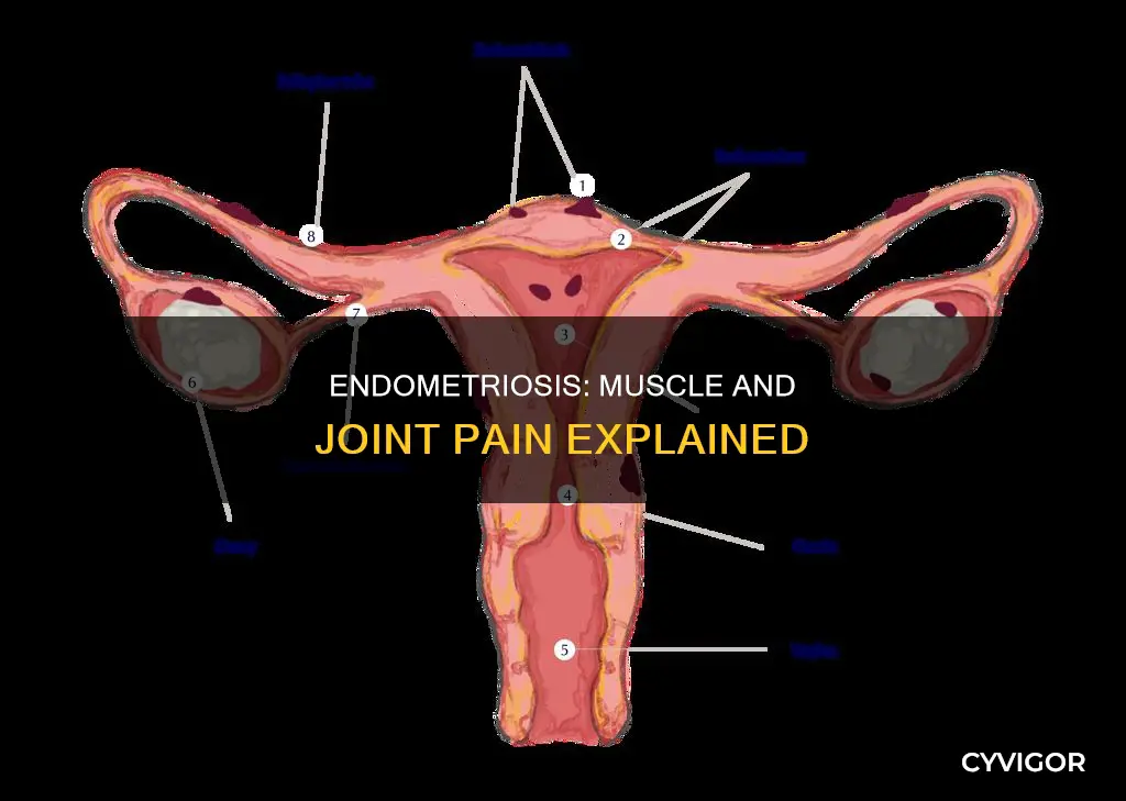 Endometriosis: Muscle And Joint Pain Explained | CyVigor