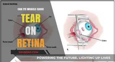 Eye Strain And Dizziness: What's The Link? | CyVigor