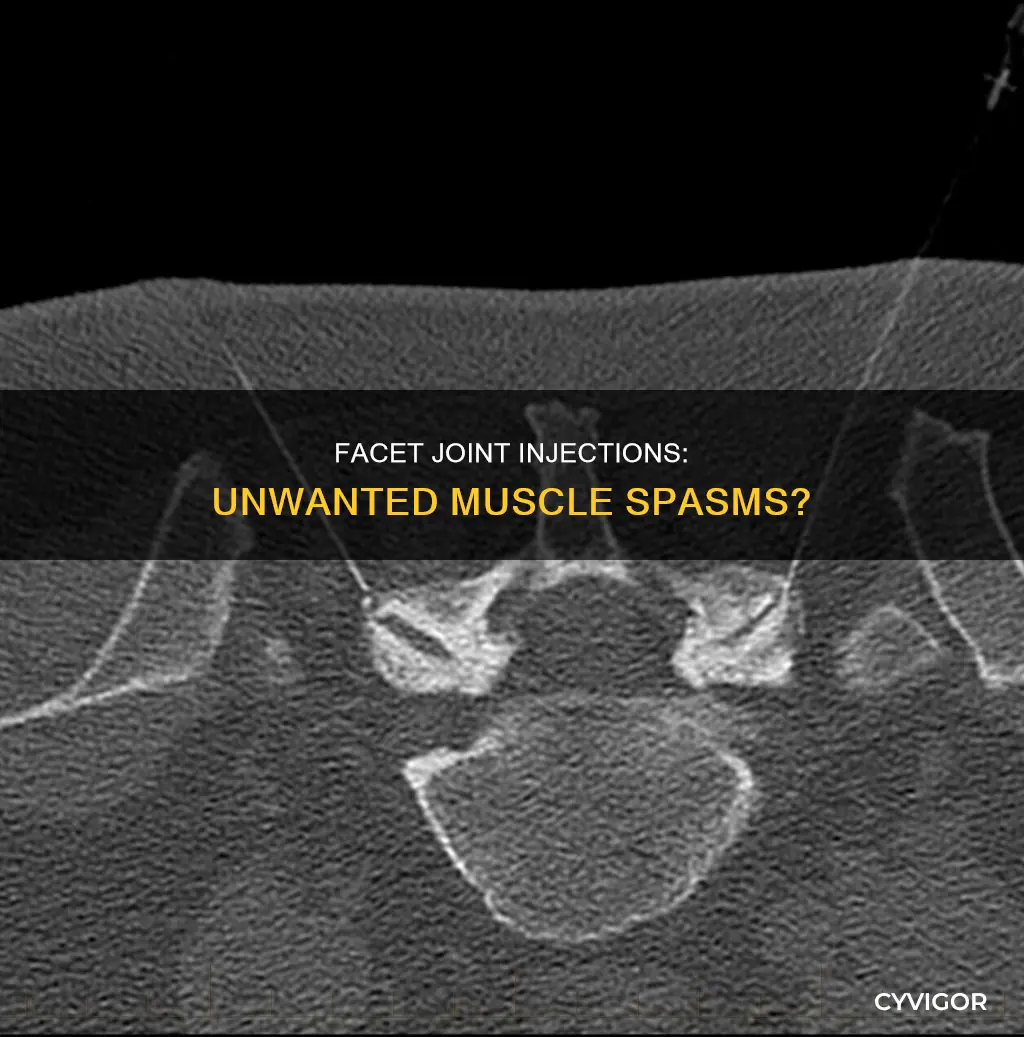 Facet Joint Injections: Unwanted Muscle Spasms? | CyVigor