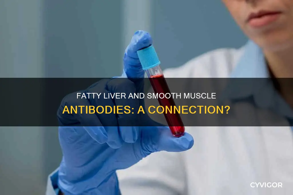 Fatty Liver And Smooth Muscle Antibodies: A Connection? | CyVigor