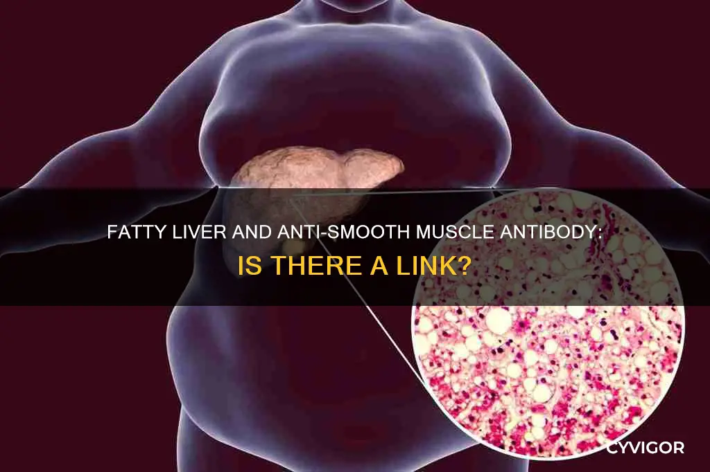 Fatty Liver And Anti-Smooth Muscle Antibody: Is There A Link? | CyVigor