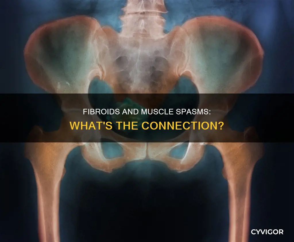 Fibroids And Muscle Spasms: What's The Connection? | CyVigor
