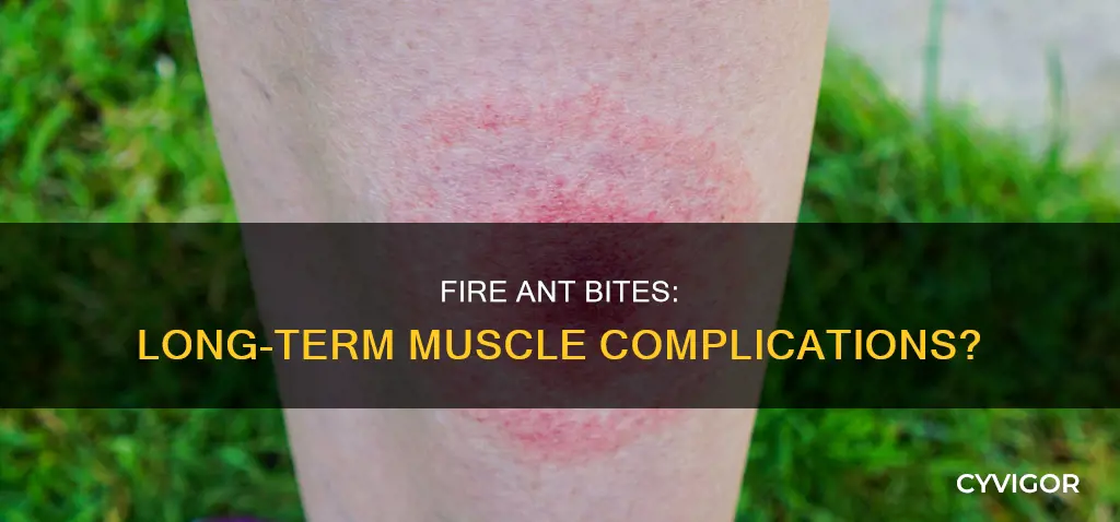 Fire Ant Bites: Long-Term Muscle Complications? | CyVigor