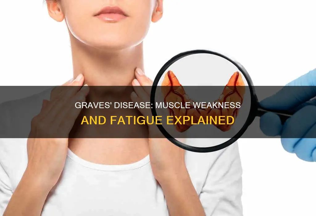 Graves' Disease: Muscle Weakness And Fatigue Explained | CyVigor