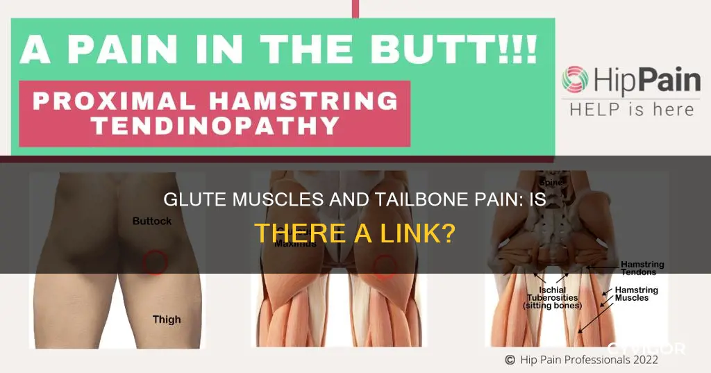 Glute Muscles And Tailbone Pain: Is There A Link? | CyVigor