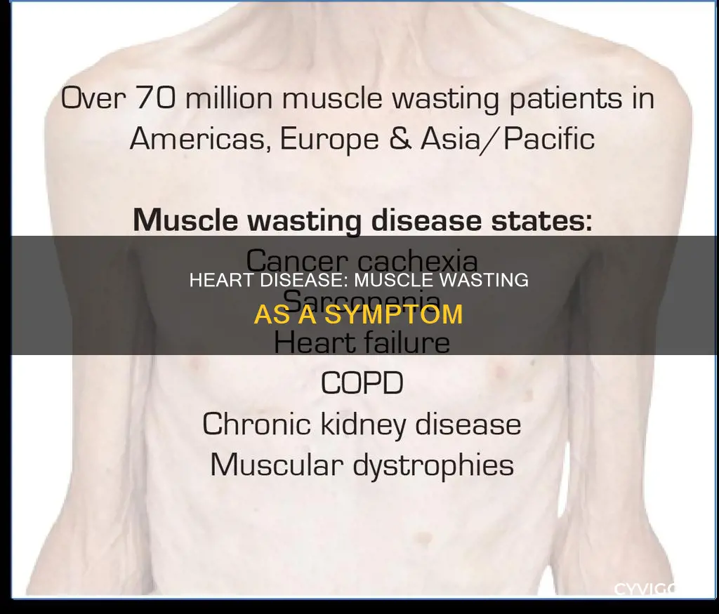 Heart Disease: Muscle Wasting As A Symptom | CyVigor
