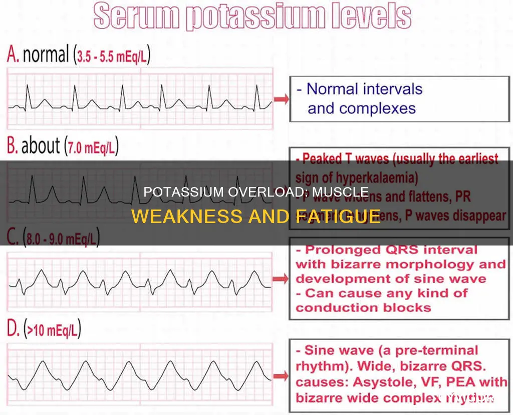 Potassium Overload: Muscle Weakness And Fatigue | CyVigor