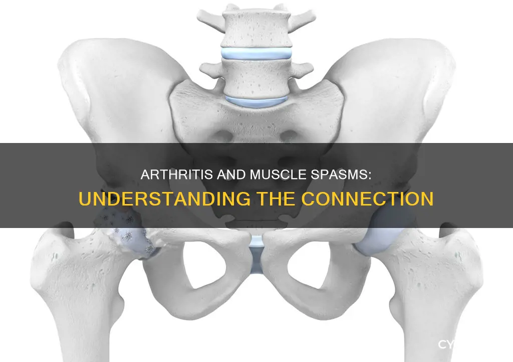 Arthritis And Muscle Spasms: Understanding The Connection | CyVigor