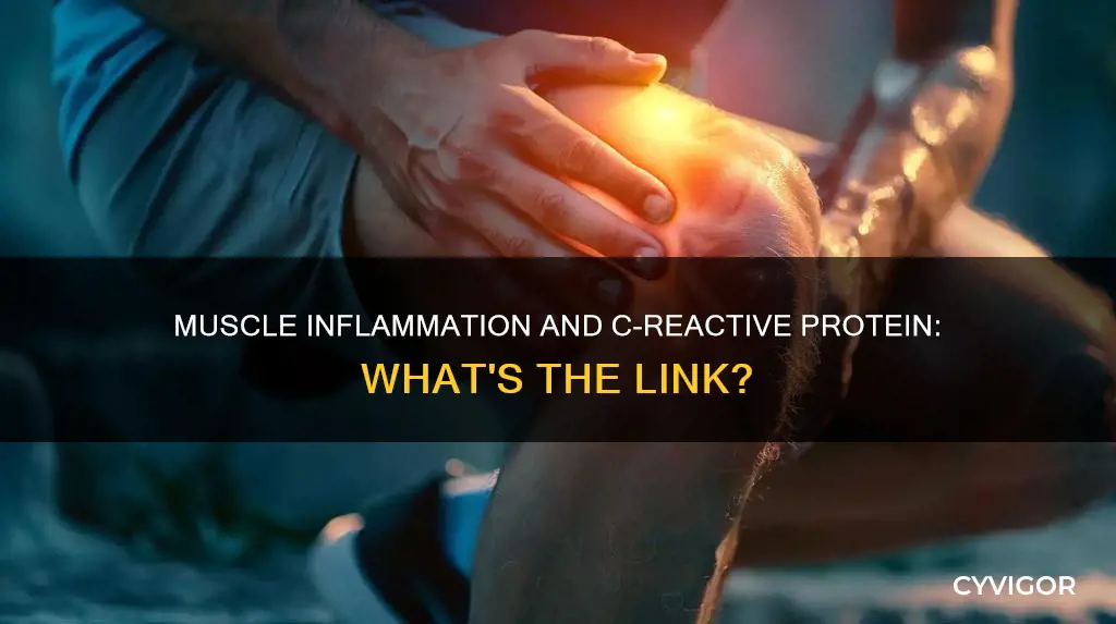 Muscle Inflammation And C-Reactive Protein: What's The Link? | CyVigor
