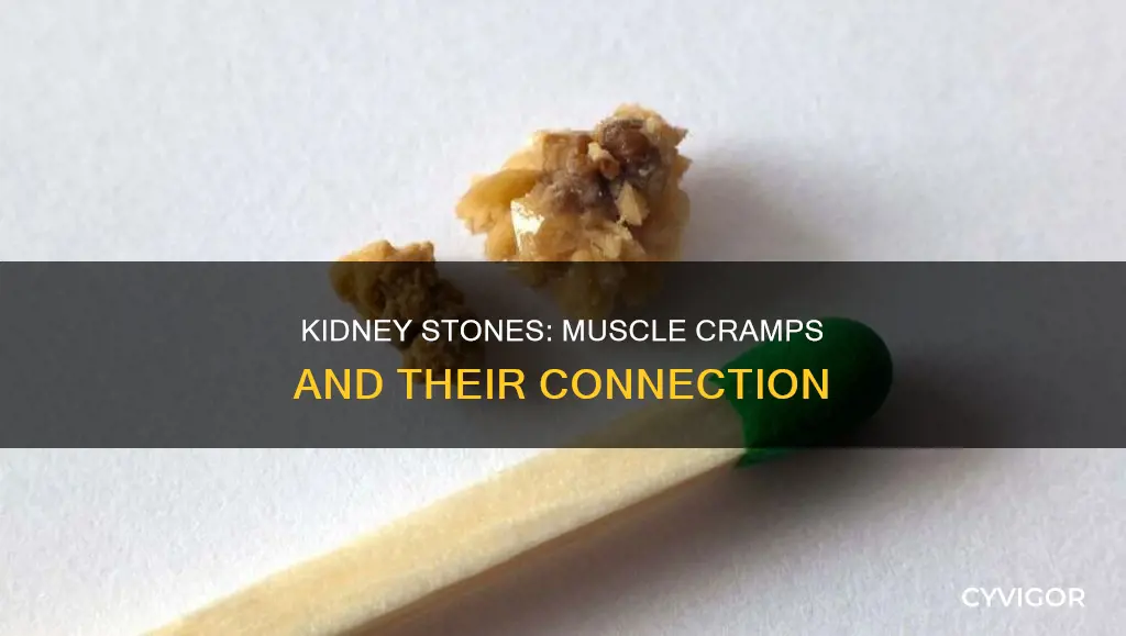 Kidney Stones: Muscle Cramps And Their Connection | CyVigor