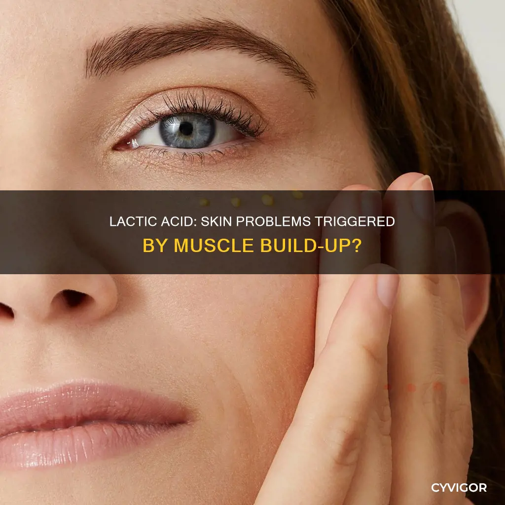 Lactic Acid: Skin Problems Triggered By Muscle Build-Up? | CyVigor