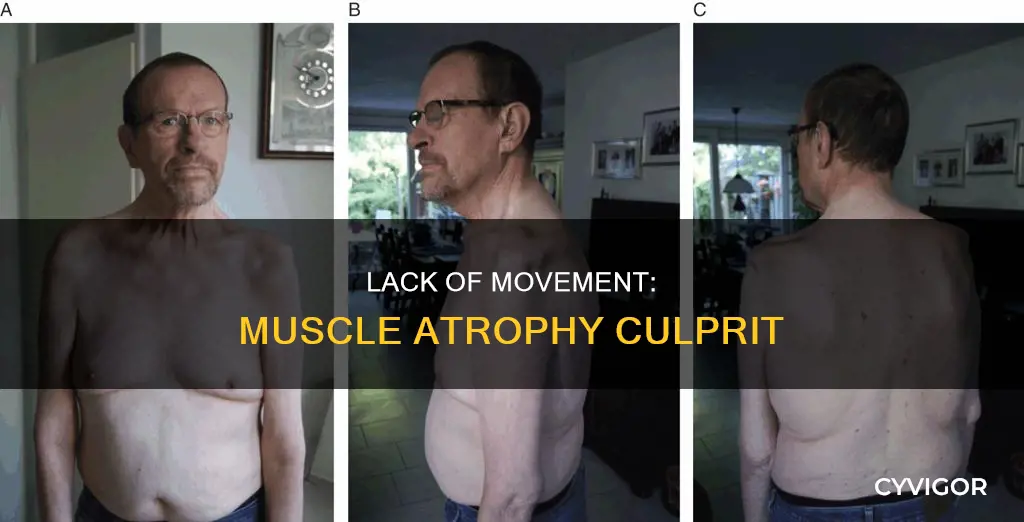 Lack Of Movement: Muscle Atrophy Culprit | CyVigor