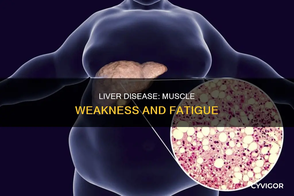 Liver Disease: Muscle Weakness And Fatigue | CyVigor