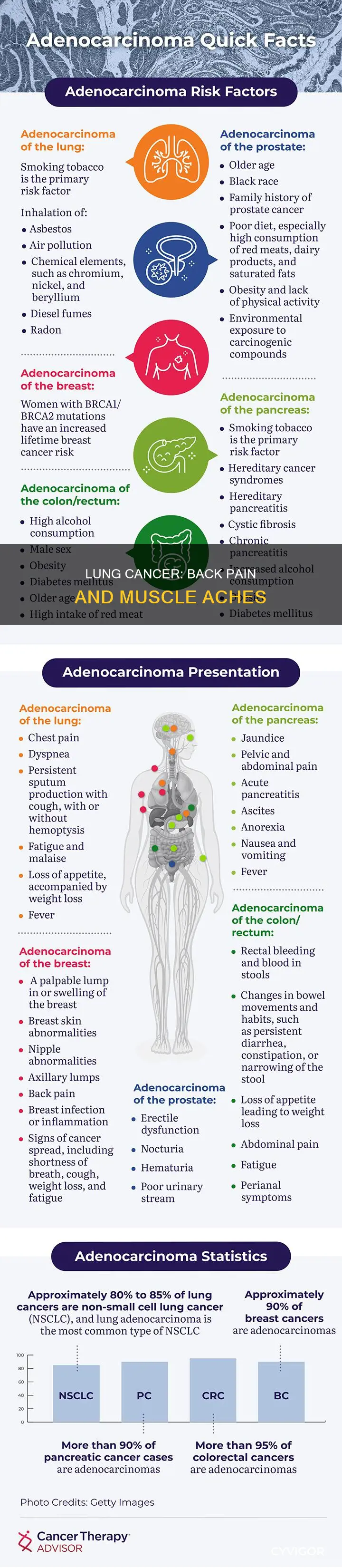 Lung Cancer: Back Pain And Muscle Aches | CyVigor