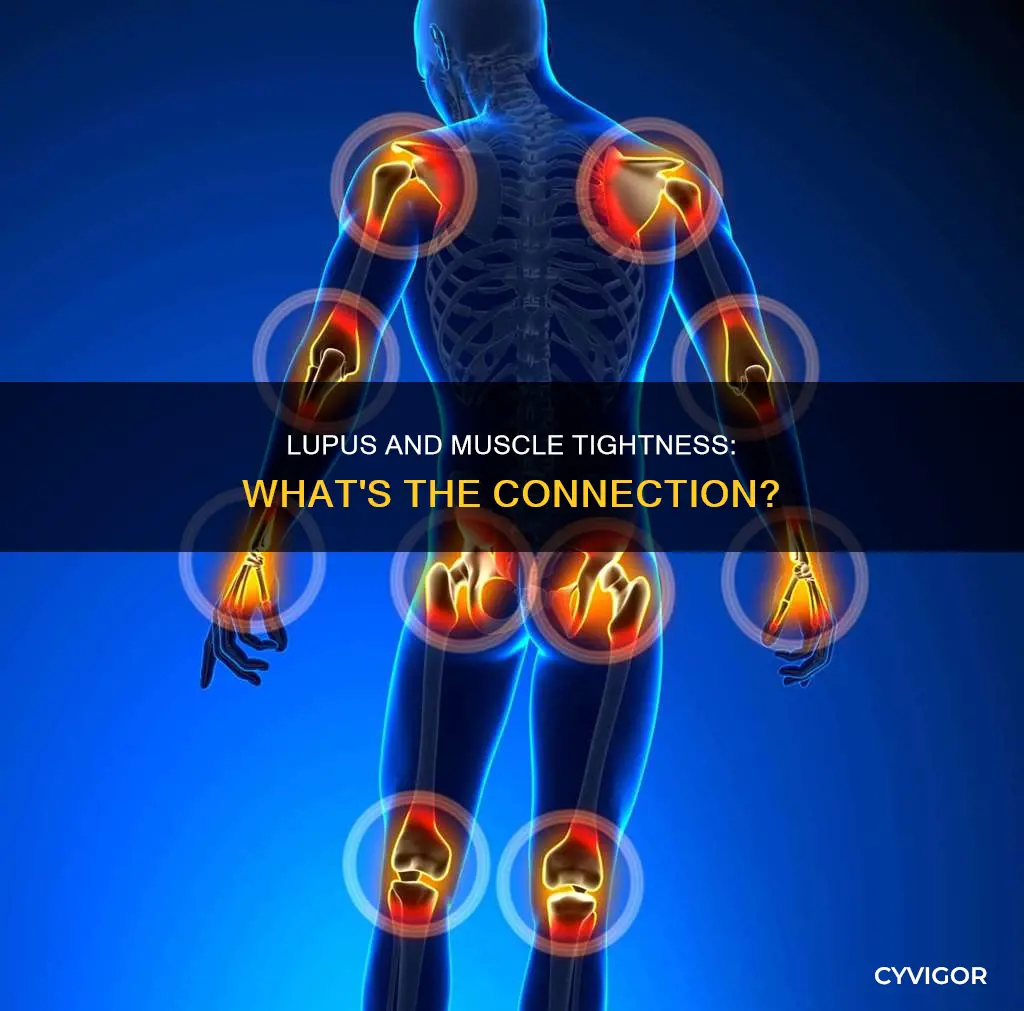 Lupus And Muscle Tightness: What's The Connection? | CyVigor